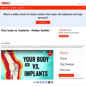 Your body vs. Implants - Kaitlyn Sadtler :: Resources :: Ascend ...